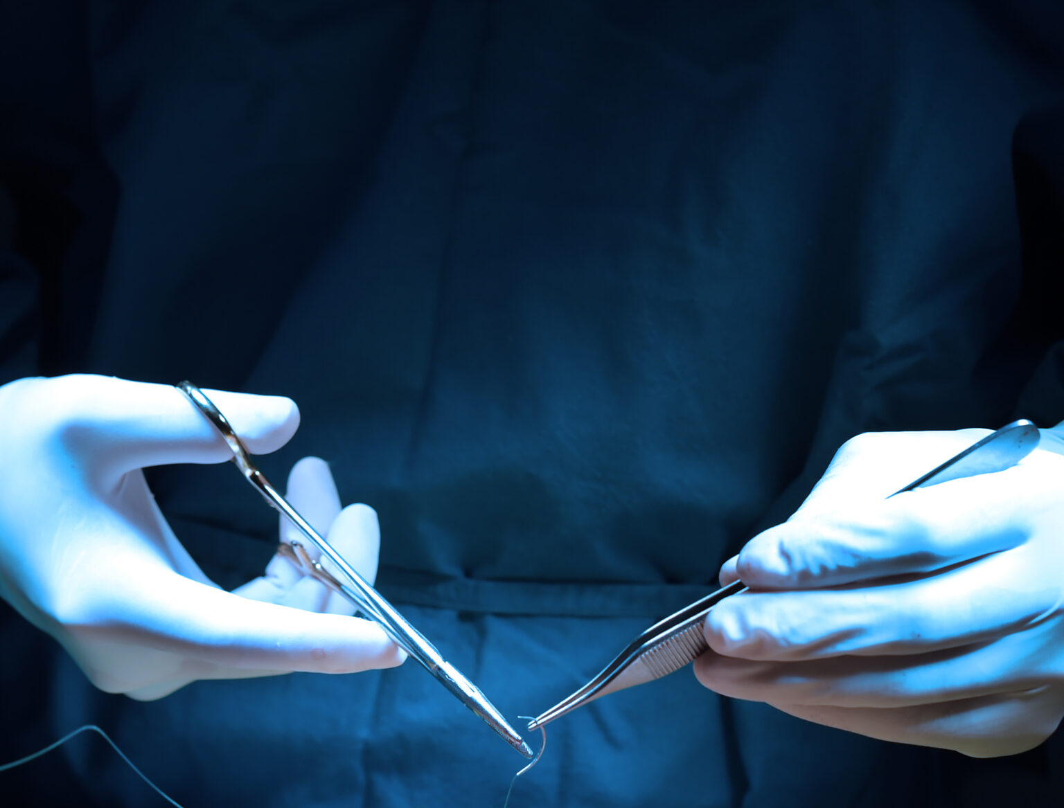 Leading Minor Surgery Services Luton | Thornhill Clinic
