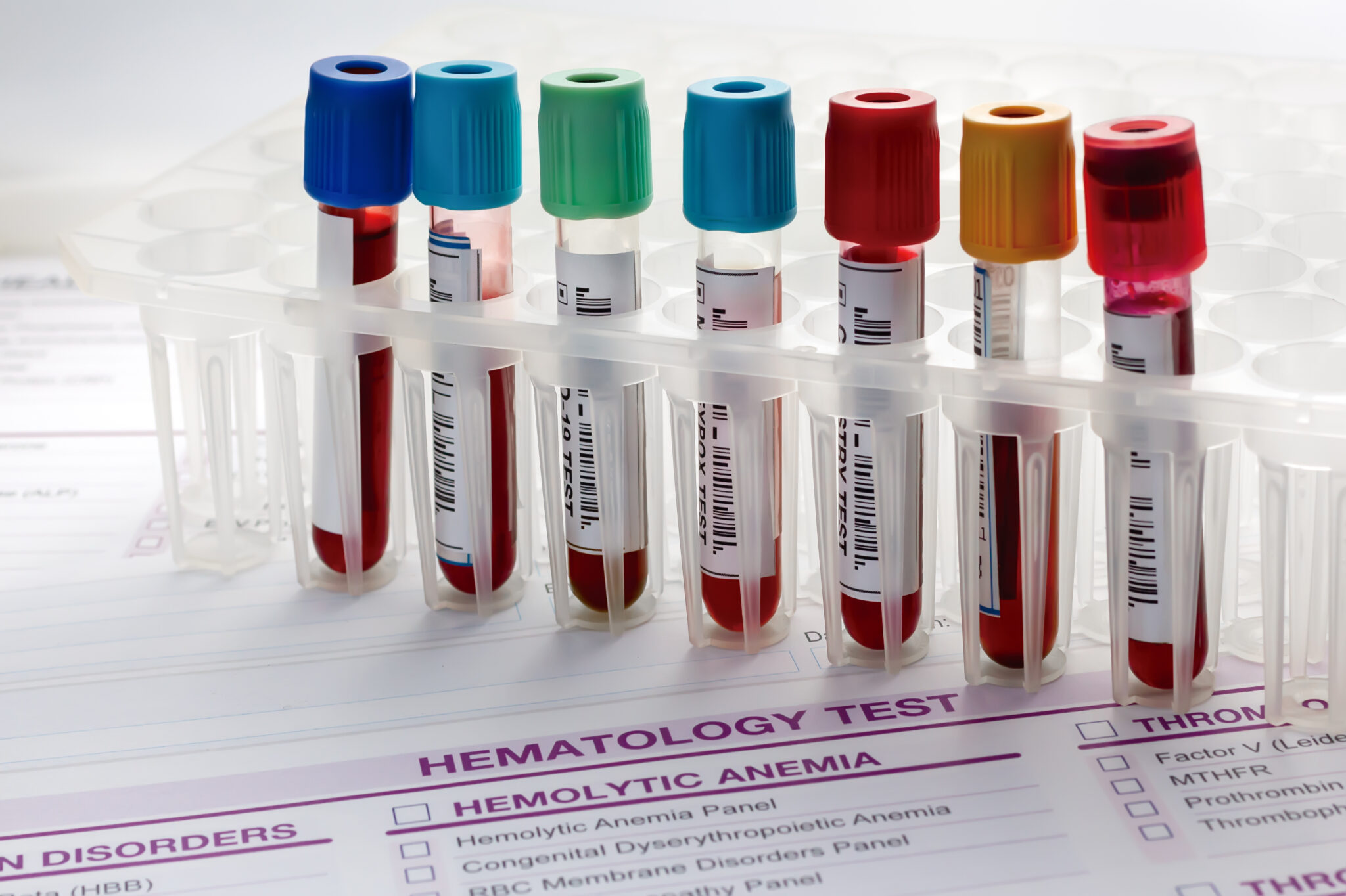 Fast & Reliable Private Blood Tests Luton | Thornhill Clinic